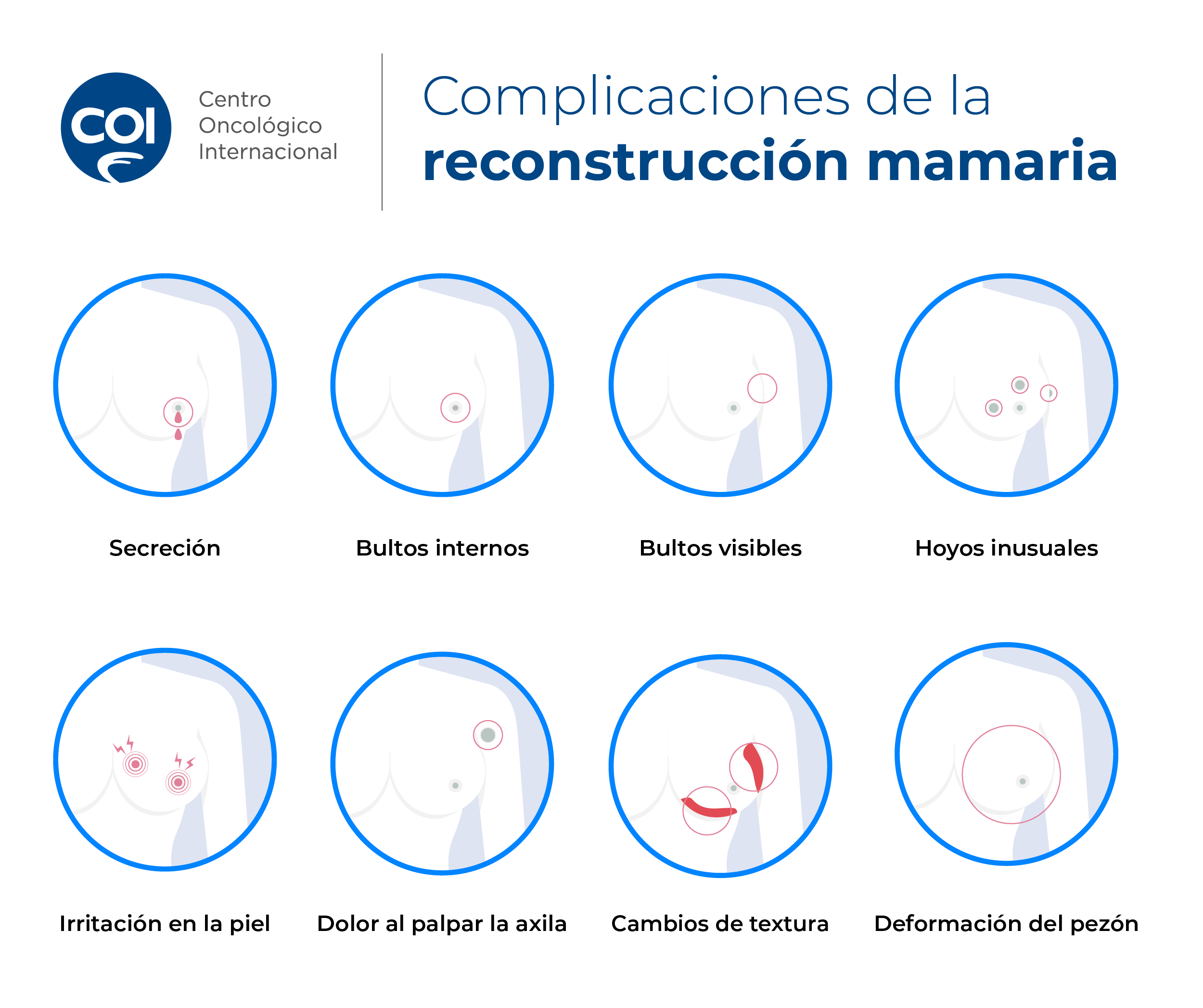 ¿Qué es la reconstrucción mamaria? Tipos, procedimiento, riesgos y ...